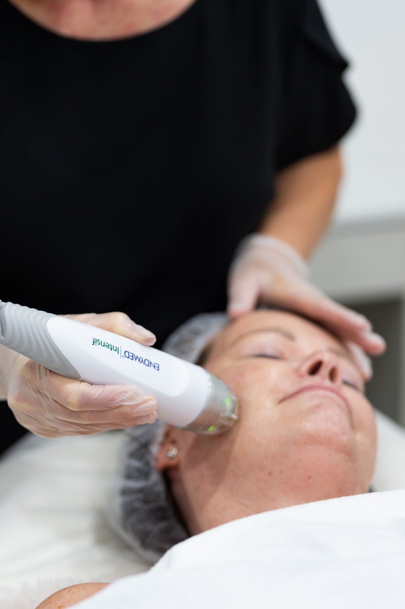 Micro-Needling vs. Radio Frequency Micro-Needling - Laser Skin Centre