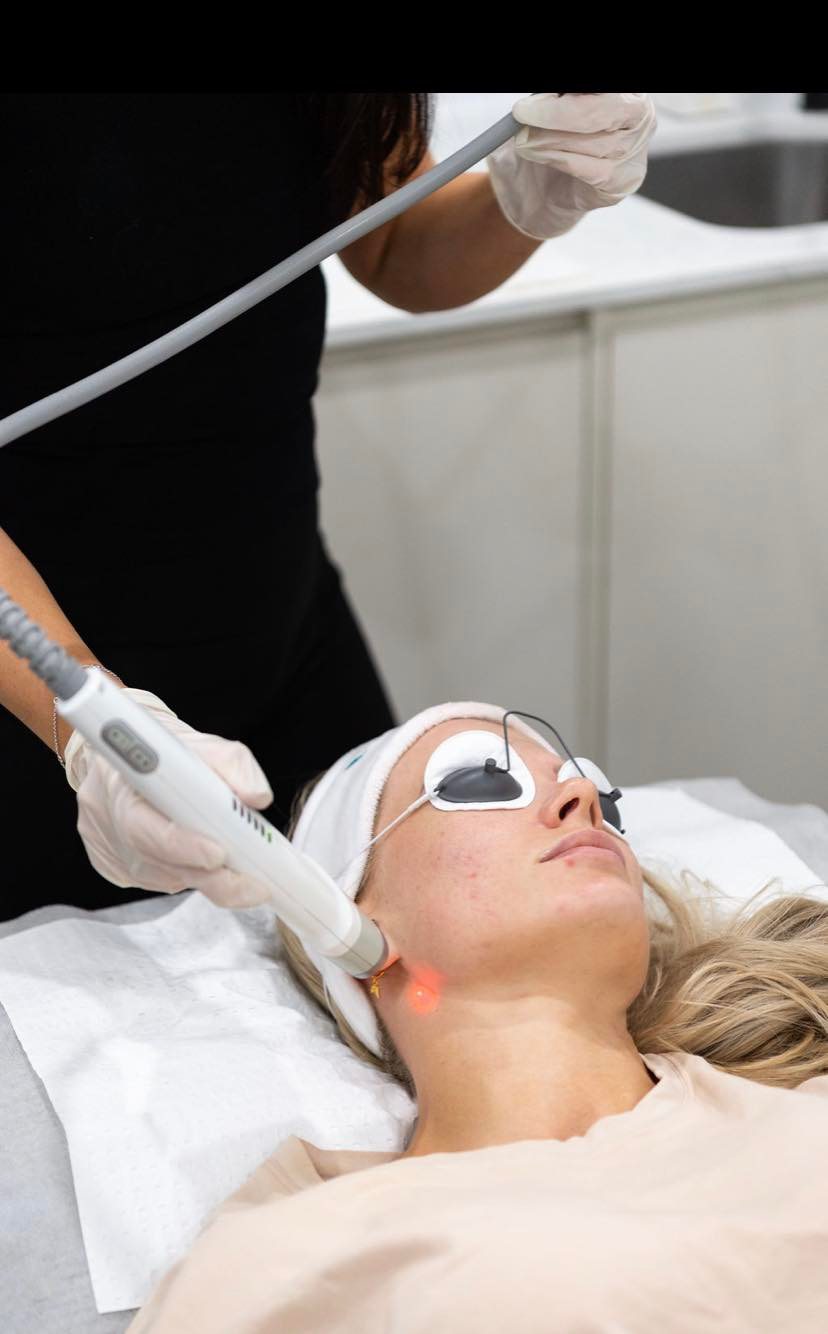 Vascular Skin Concerns - Laser Skin Centre